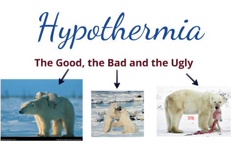 Hypothermia by Angus Goodson on Prezi