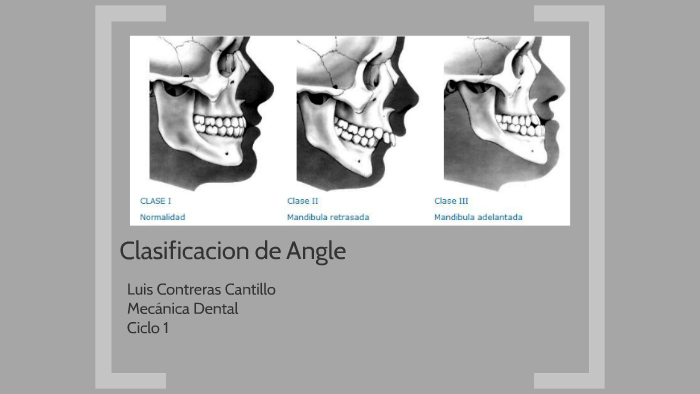Clasificación de Angle by Luis Alfredo Contreras Cantillo on Prezi