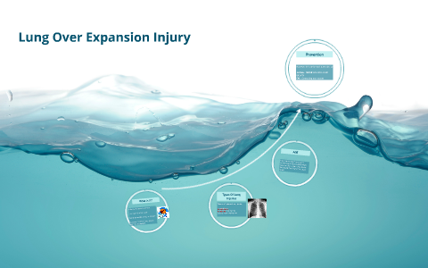 Lung Over Expansion Injury by Hau Yang ng on Prezi