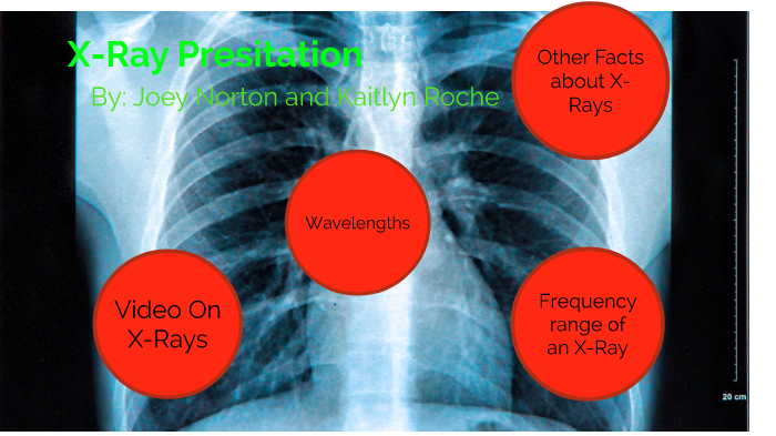 X-Rays by Kaitlyn Roche on Prezi