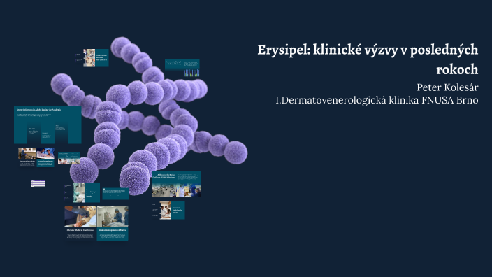 Erysipel: Clinical Challenges in Recent Years by Peter Kolesar on Prezi