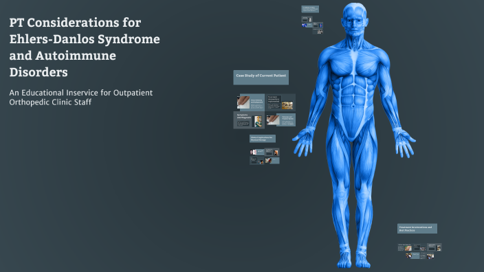 PT Considerations for Ehlers-Danlos Syndrome and Autoimmune Disorders ...