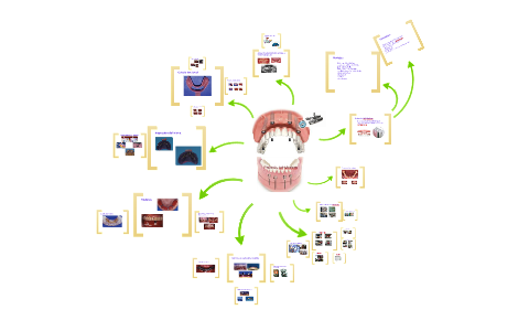 Prótesis Ad-Modum by Rom Ina on Prezi