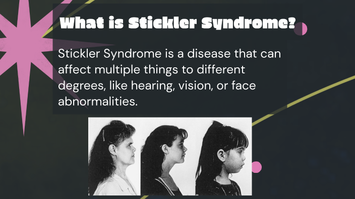 Stickler Type by Julian Garcia on Prezi