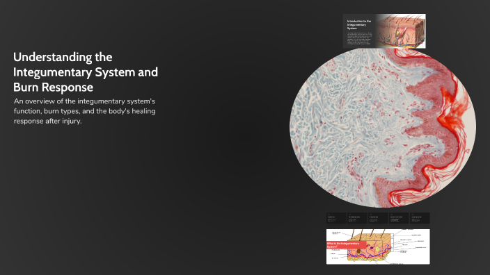 Understanding the Integumentary System and Burn Response by Aaron Maggo ...