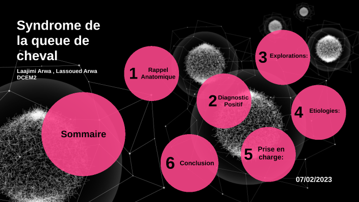 Syndrome de la queue de cheval by arwa lassoued on Prezi