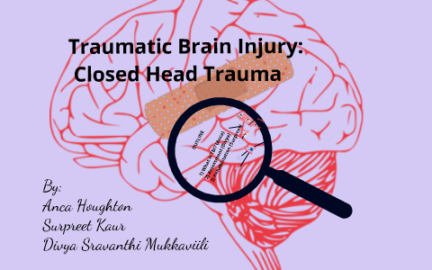 Traumatic Brain Injury: Closed Head Trauma by Anca Houghton on Prezi