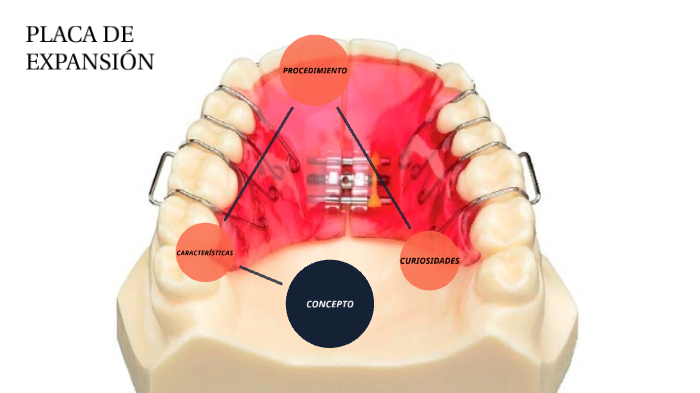 PLACA DE EXPANSIÓN by Noelia Limón Domínguez on Prezi