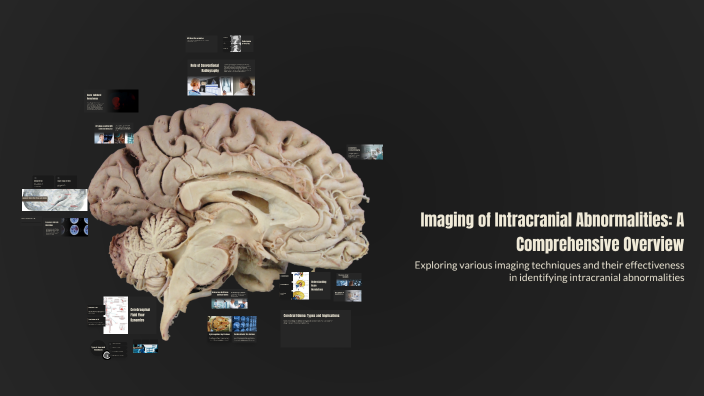 Imaging of Intracranial Abnormalities: A Comprehensive Overview by ...