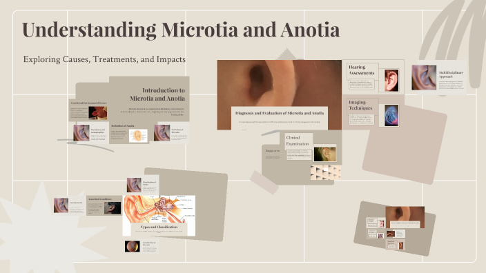 Understanding Microtia and Anotia by Jayden Carlos on Prezi