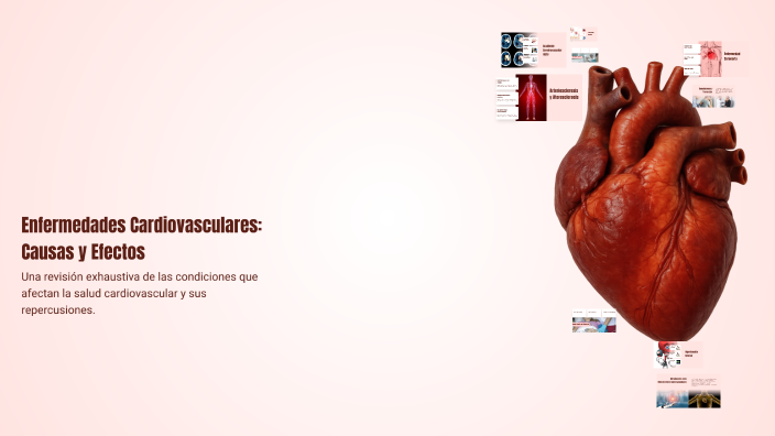 Enfermedades Cardiovasculares: Causas y Efectos by SERGIO RODRIGO ...
