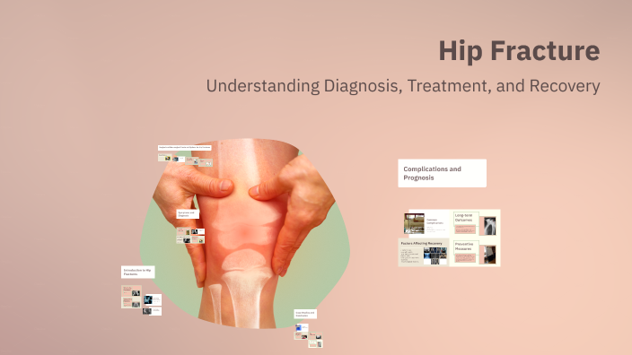 Hip Fracture Presentations by German Ramboyong on Prezi