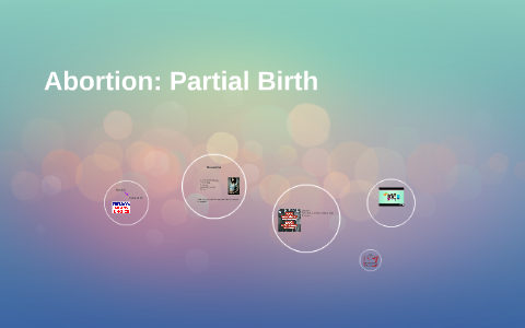 Abortion: Partial Birth by Bailey Ceneviva on Prezi