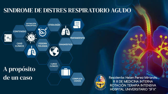 SDRA by Sanders HP on Prezi