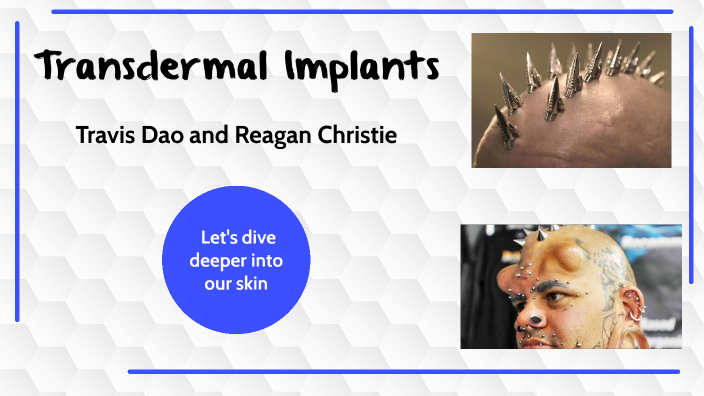 Transdermal Implants by Travis-Thuan Dao on Prezi