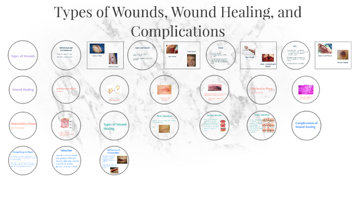 Types of Wounds, Wound Healing, and Complications by Raden Cuntapay on ...