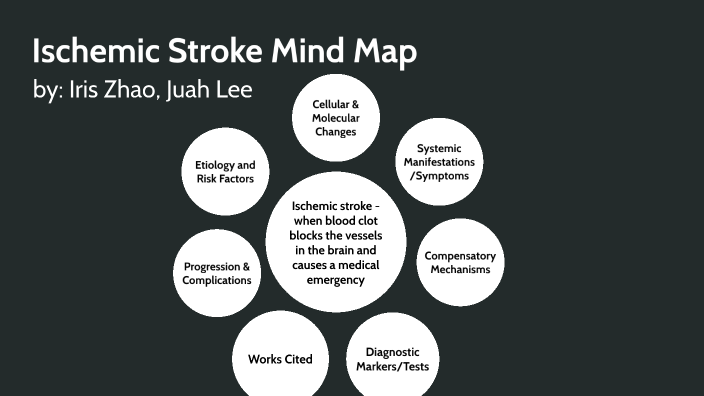 Ischemic Stroke Mind Map by Iris Zhao on Prezi