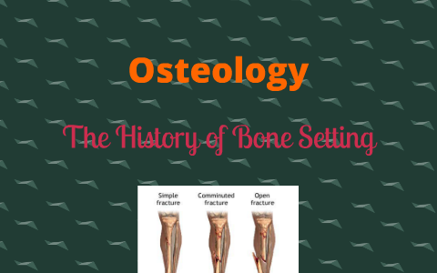 History of Bone Setting by courtney stefanik on Prezi