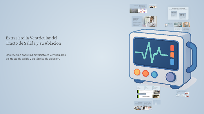 Extrasistolia Ventricular del Tracto de Salida y su Ablación by María ...