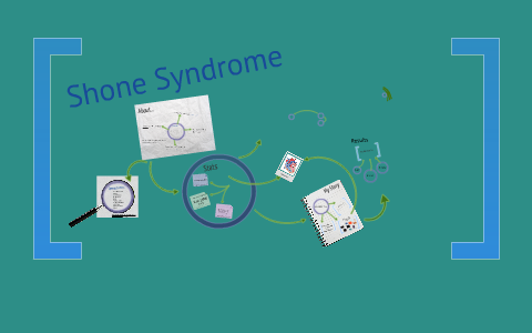 Shone Syndrome by Leah Loostrom on Prezi