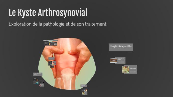 Le Kyste Arthrosynovial by Lyla sch on Prezi