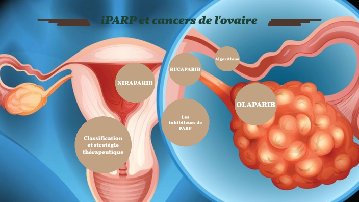 Topo iPARP et cancers de l'ovaire by Hugues Vandenberghe on Prezi