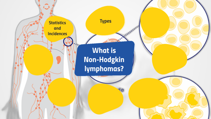 Overview of NHL by Kim Hope on Prezi
