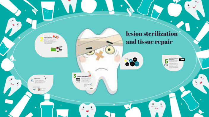 lesion sterilization and tissue repair by Haidy Ehab on Prezi lesion sterilization and tissue repair by Haidy Ehab on Prezi