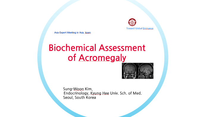 Biochemical Assessment of Acromegaly by Sung-Woon Kim on Prezi
