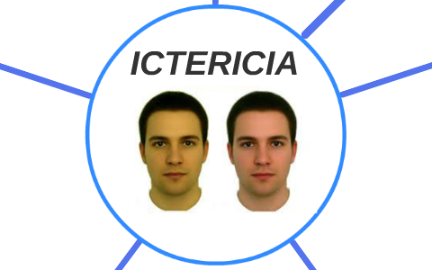 ICTERICIA by jennifer espejo on Prezi