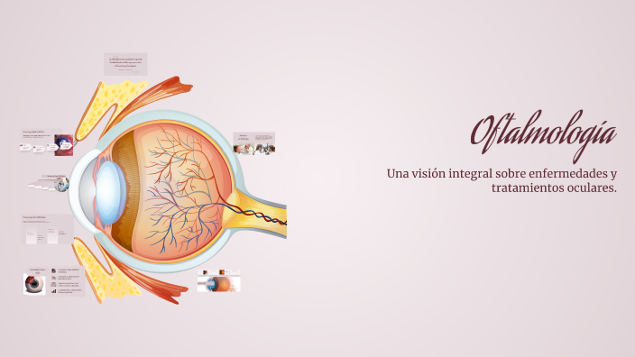 Oftalmología by Kerly Escalante on Prezi
