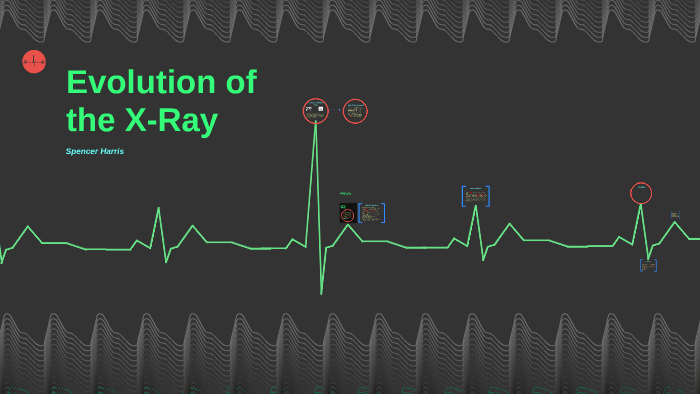 Evolution of the X-Ray by Spencer Harris