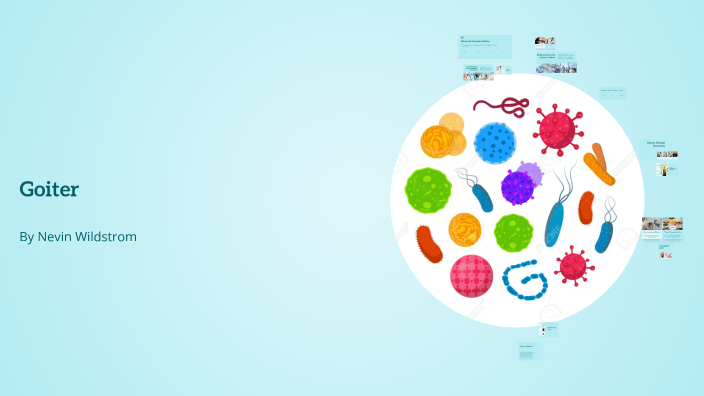 Understanding Goiter and Thyroid Disorders by Nevin Wildstrom on Prezi