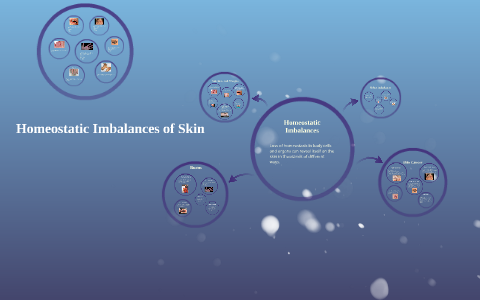 Homeostatic Imbalances of Skin by Kelly Dineen on Prezi