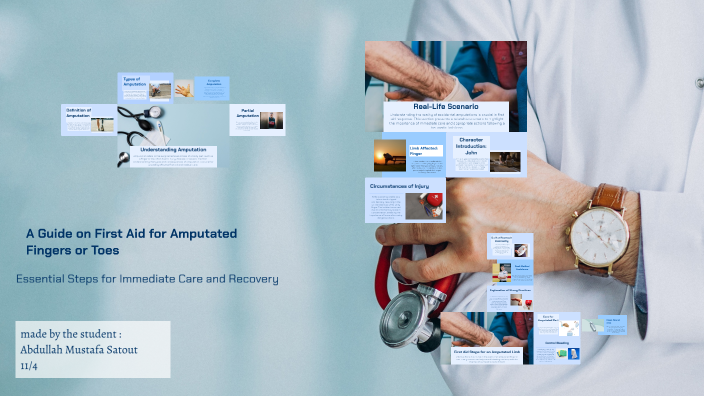 A Guide on First Aid for Amputated Fingers or Toes by Ab ST on Prezi