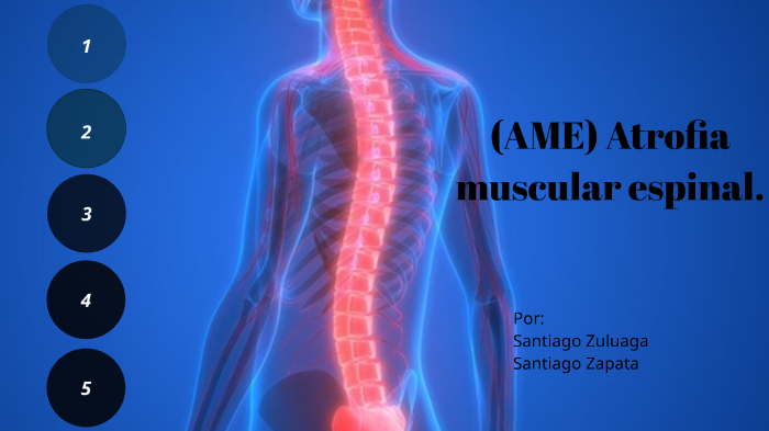 Atrofia muscular progresiva by Santiago Zapata Duque on Prezi