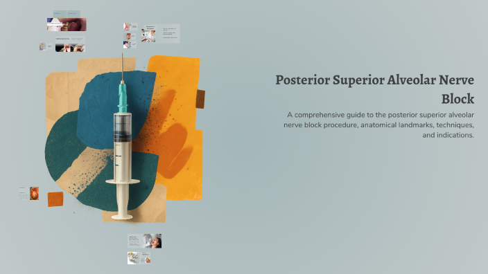 Posterior Superior Alveolar Nerve Block by Rayan Ahmed on Prezi
