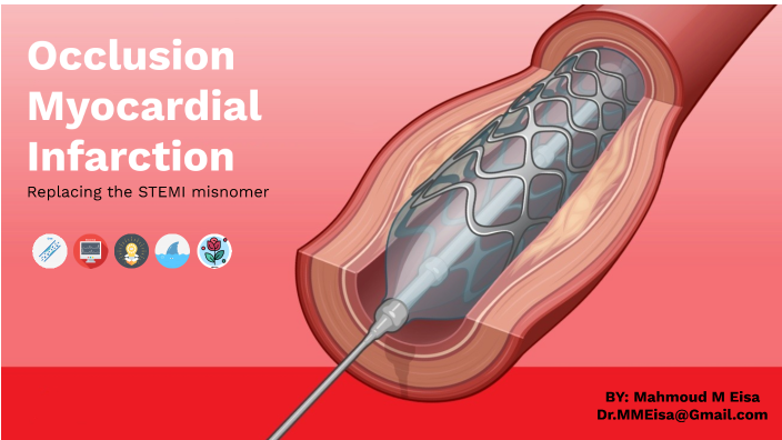 Occlusion MI by Mahmoud M Eisa on Prezi