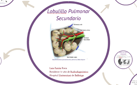 Lobulillo Pulmonar Secundario by on Prezi