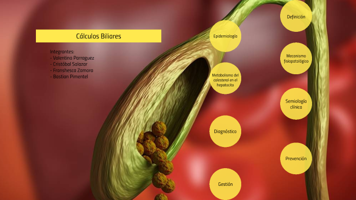 Cálculos Biliares by franshesca zamora on Prezi