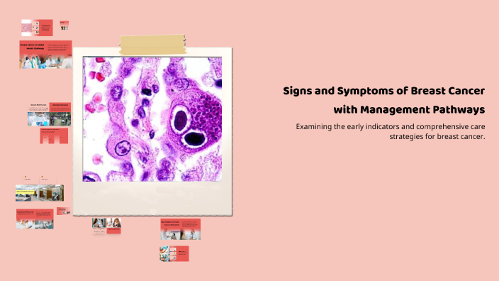 Signs and Symptoms of Breast Cancer with Management Pathways by Mae Ann ...