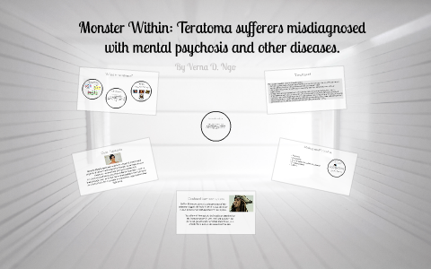 Monster Within: Teratoma sufferers misdiagnosed of mental ps by Verna ...