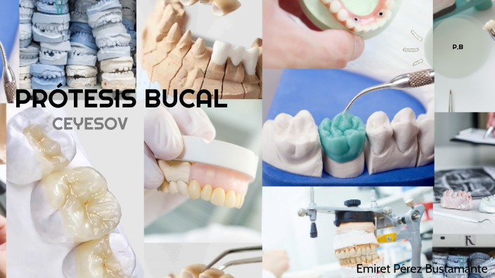 PROTESIS by Emiret Bustamante on Prezi