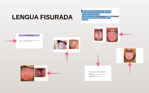 LENGUA FISURADA by Gustavo Ojeda on Prezi