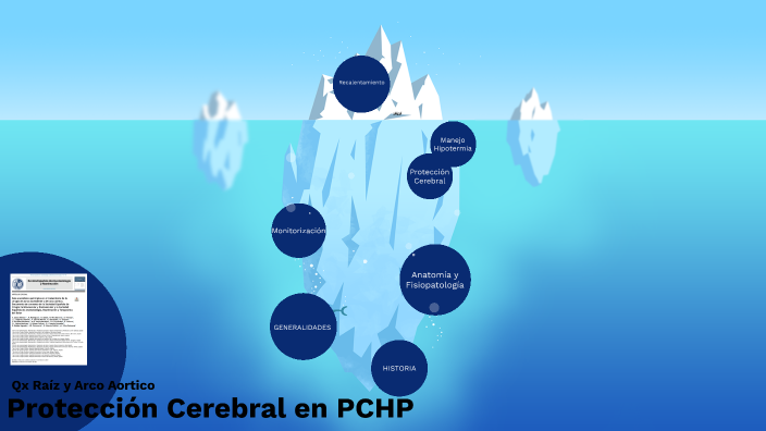 Protección Cerebral en PCHP by cesar riquelme on Prezi