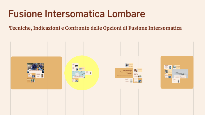 Fusione Intersomatica Lombare by Andrea Giovannini on Prezi
