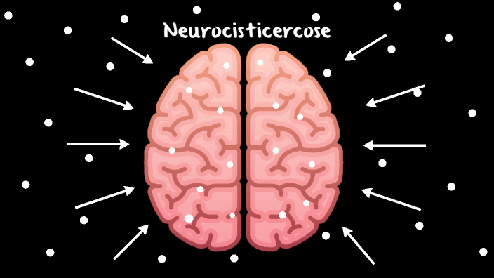 Neurocisticercose by Thainá Gameleira on Prezi