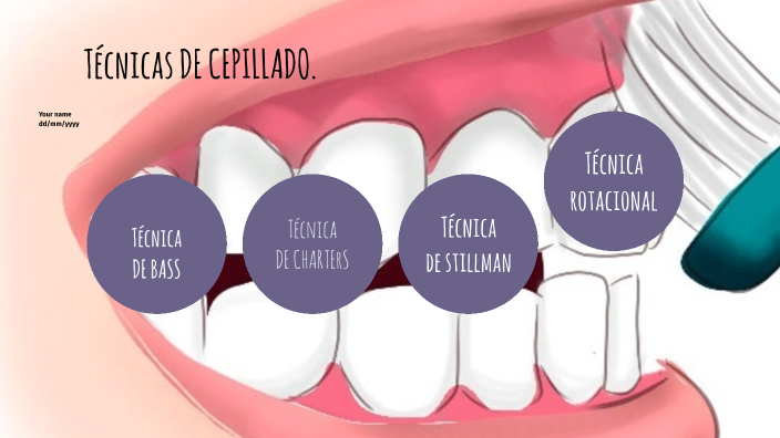 Técnicas de cepillado by Valeria Rodriguez on Prezi