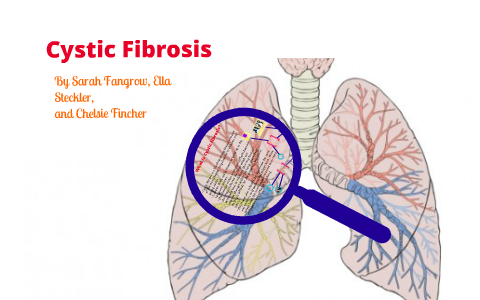 Cystic Fibrosis by Chelsie Fincher on Prezi