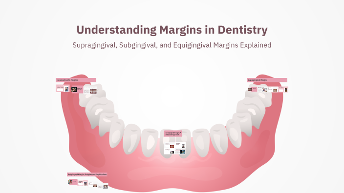 Understanding Margins in Dentistry by Ceren Baran on Prezi
